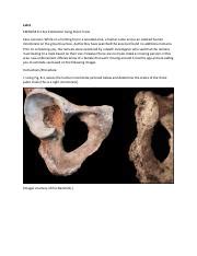 Forensic Anthropology Sex Estimation Techniques Course Hero