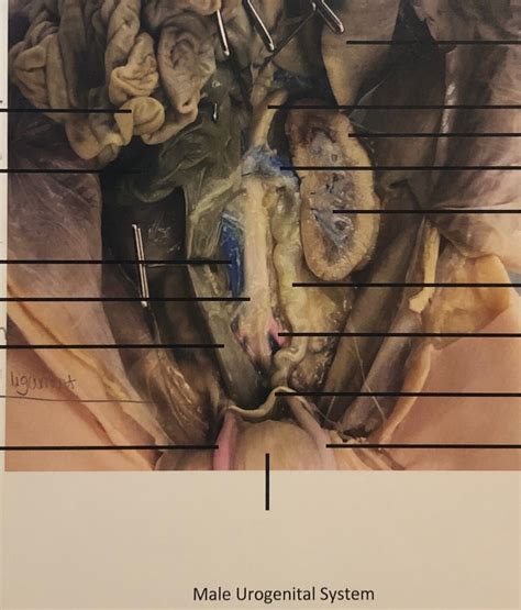 Male Urogenital System Diagram Quizlet