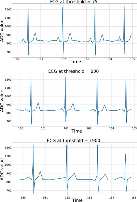 Ecg Signal Sub Sampled With The Proposed Algorithm Using Three