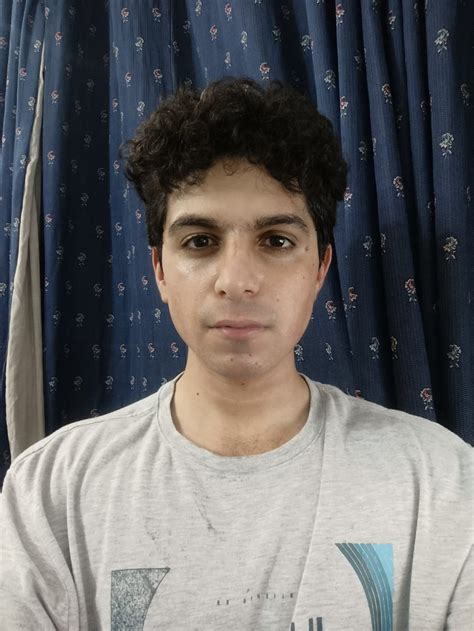 Question About Recessed Maxilla Rjawsurgery