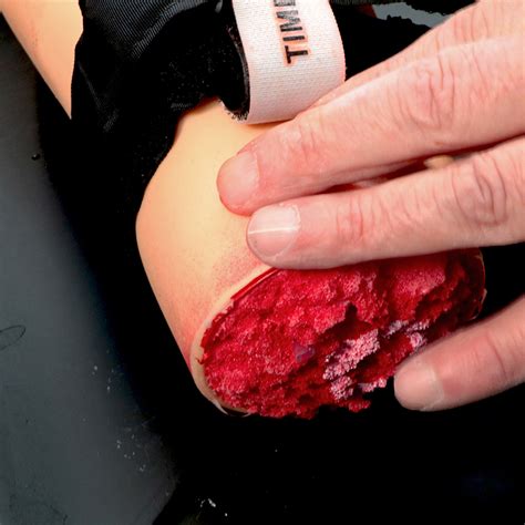 Arm Amputation And Bleeding Control Trainer Realityworks
