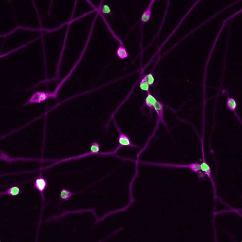 Differentiation Of Rgc Induced Neurons Rgc Ins