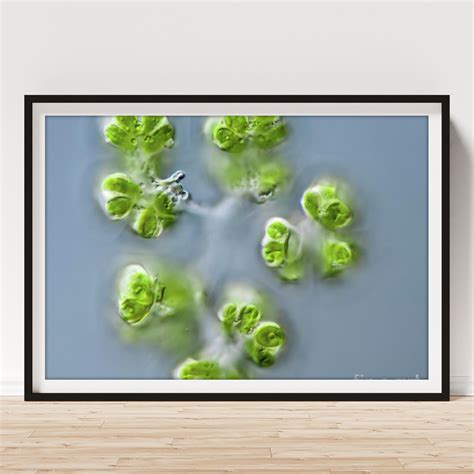 Botryococcus Sp Algae 1 Poster By Science Photo Library Science Photo Gallery