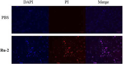 Dapi And Pi Staining Results Of S Aureus Treated With Pbs And Ru‐2 Download High
