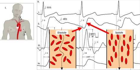 Background On Electrical Cardiometry Ec Ec Works By Sending Current Download Scientific
