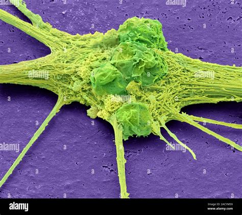 Stem Cell Derived Neuron Coloured Scanning Electron Micrograph Sem