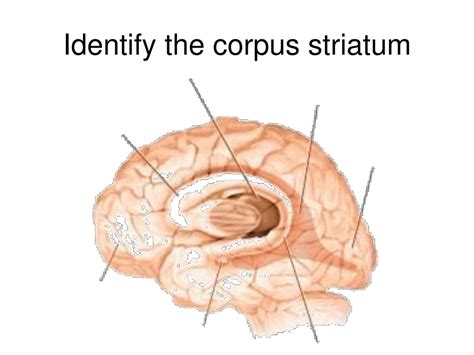 Ppt Comprehensive Review Of Mri Sectional Anatomy Brain Bones Landmarks And Protective
