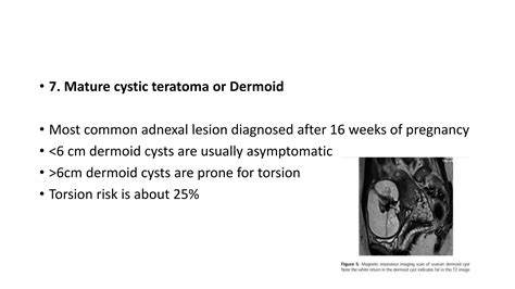Adnexal Masses In Pregnancy Pptx