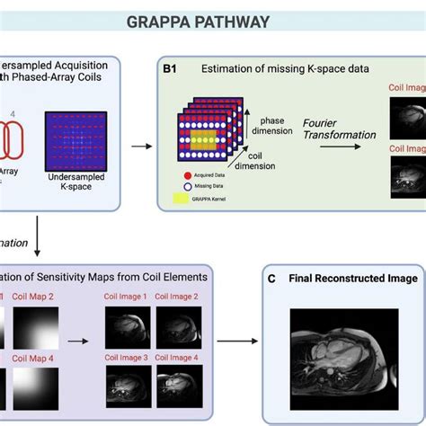Depiction Of The Compressed Sensing Concept Compressed Sensing Download Scientific Diagram