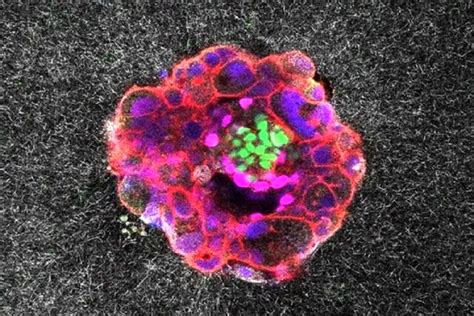 ثبت تصاویر ۳ بُعدی از لانه‌گزینی جنین انسان برای اولین بار