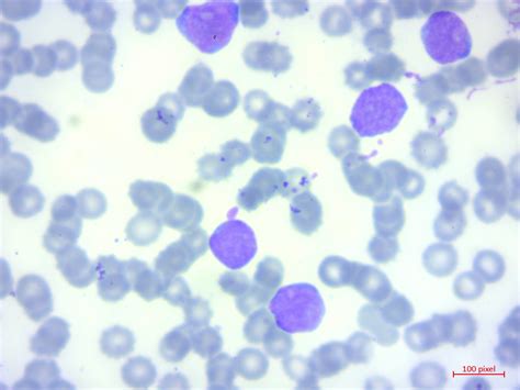 All Roboflow Dataset Object Detection Dataset By Andreys Workspace