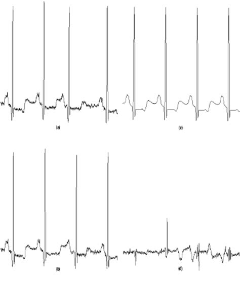Steps Of Processing A Original Signal B Normalized Signal C Download Scientific