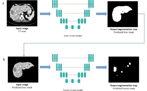 Automatic Segmentation Process A The Liver U Net Model Receives The Download Scientific