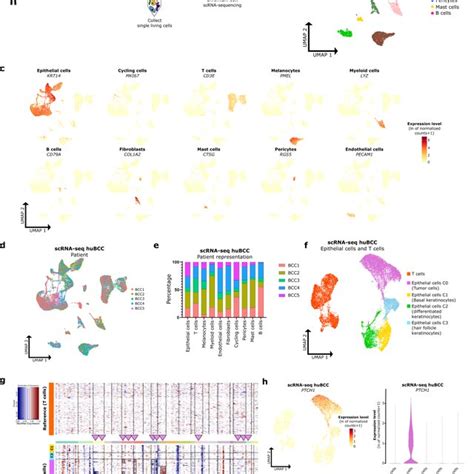 Scrna Seq Resolves The Heterogeneous Cell Composition Of Infiltrative Download Scientific