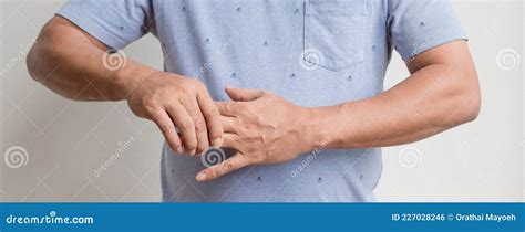 Numbness And Tingling Is A Symptom Of Ulnar Tunnel Syndrome Also Known As Guyons Canal