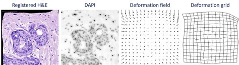 Hande To Xenium Dapi Image Registration With Fiji 10x Genomics
