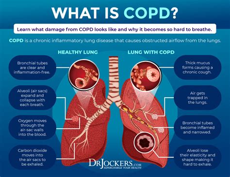 Copd Symptoms Causes And Support Strategies