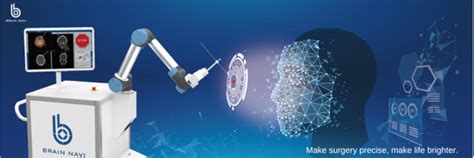 Elevating Neuro Navigation With Innovative Surface Matching With Naotrac