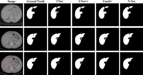 Results On Three Images On The Liver Dataset Download Scientific Diagram