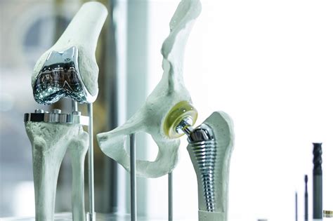 Titanium Gets Even Better With One Part Gold Analyzing Metals