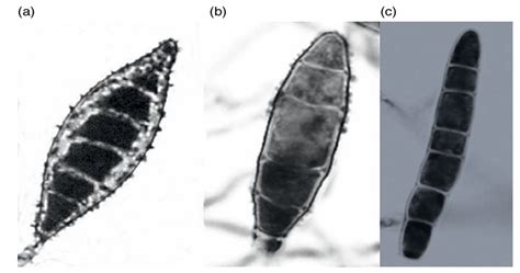 การเพาะเชื้อรา Dermatophyte Best Equipment Center Co Ltd Bec