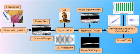 Figure 1 From Unseen Artificial Intelligence—deep Learning Paradigm For Segmentation Of Low