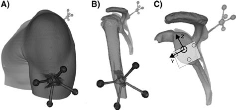 A Representation Of The Ct Scan Segmentation Of A Participant Fi Tted