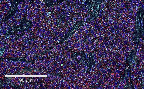 Overcoming Common Challenges With Fluorescent Ihc Fluorofinder