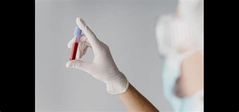 Crp Normal Range Understand Your Results