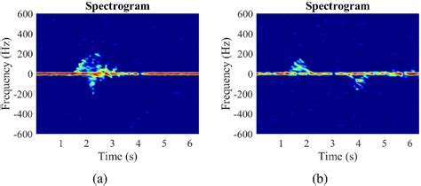 Figure 4 From Radar Based Soft Fall Detection Using Pattern Contour Vector Semantic Scholar