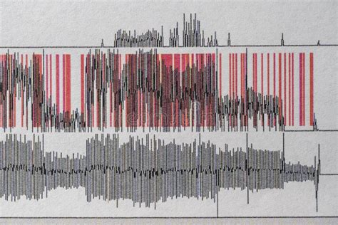 Images Charts Scientific Cardiograms Of Cardiorespiratory Sleep