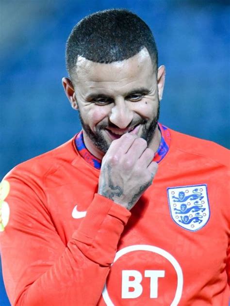 Did Kyle Walker Get A Hair Transplant Wimpole Clinic