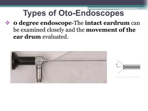 Otoendoscopy Types Uses Procedures Performed Advantages And Disadvantages Pptx