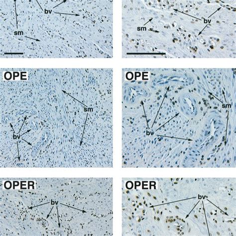 Subepithelial And Deep Cervical Stroma Morphometric Data The Mean Se