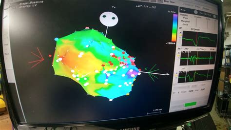 What Is The Rarest Piece Of Sgi Hardware You Own Page 2 Silicon Graphics User Group
