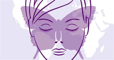 How To Test For Lupus Healthcare Nt Sickcare