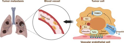 The Hypothesized Pathway Indicating Propofol Promotes Tumor Metastasis