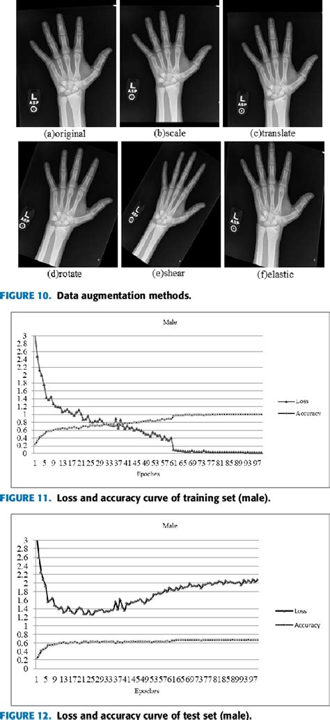 Figure 1 From Automatic Bone Age Assessment Of Adolescents Based On