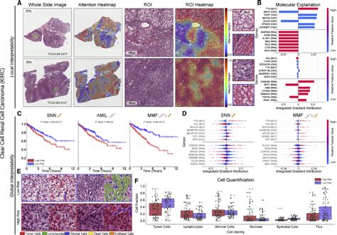 Cancer Cell 深度学习ai整合组织学和多组学等诊断多种癌症 知乎