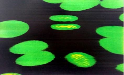 Hep 2 Cells Positive For Anti Nuclear Antibody Test Download Scientific Diagram