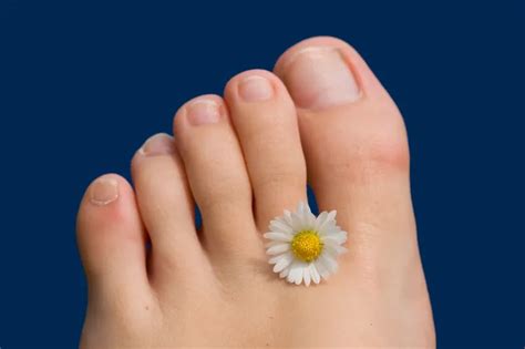 How To Prevent Foot Fungus During Spring