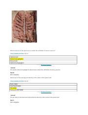 Spinal Cord Nerves And Plexi Homework Docx Which Structures Of The Spinal Nerves Contain The