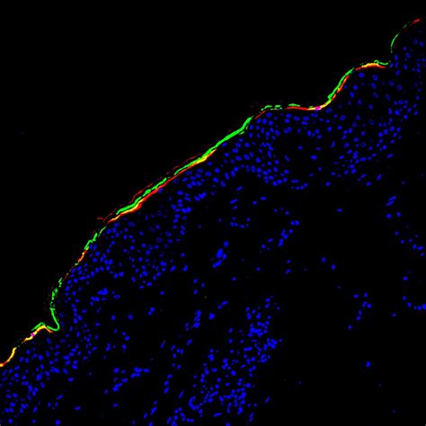 how to measure epidermis in cell profiler image analysis image sc forum