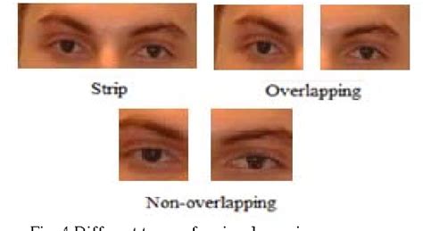 Figure 1 From Implementation Of Plastic Surgery Face Recognition Using Multimodal Biometric
