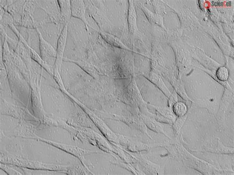 Human Brain Vascular Adventitial Fibroblasts