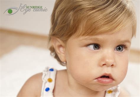 Amblyopia Signs Symptoms Treatment Sunridge Eye Clinic