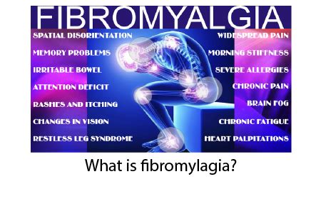 What Is Fibromyalgia Recharge Biomedical