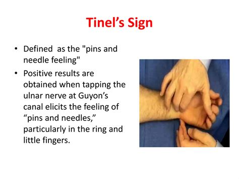 Clinical Signs Of Upper Limb Pptx