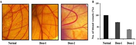 Anti Angiogenic Characteristic Of Ppb Anf A And B Antiangiogenic