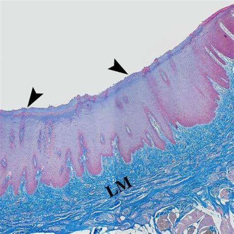 Photomicrograph Of A Vallate Papilla Showing The Lamina Propria